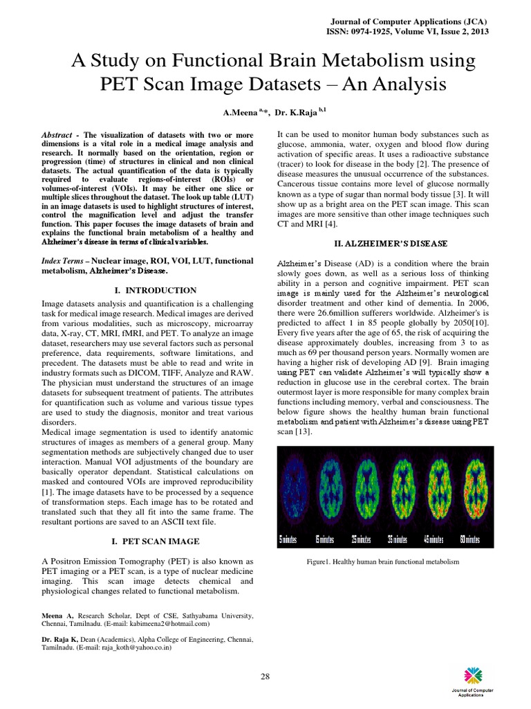 A Study On Functional Brain Metabolism Using PET Scan Image Datasets ...