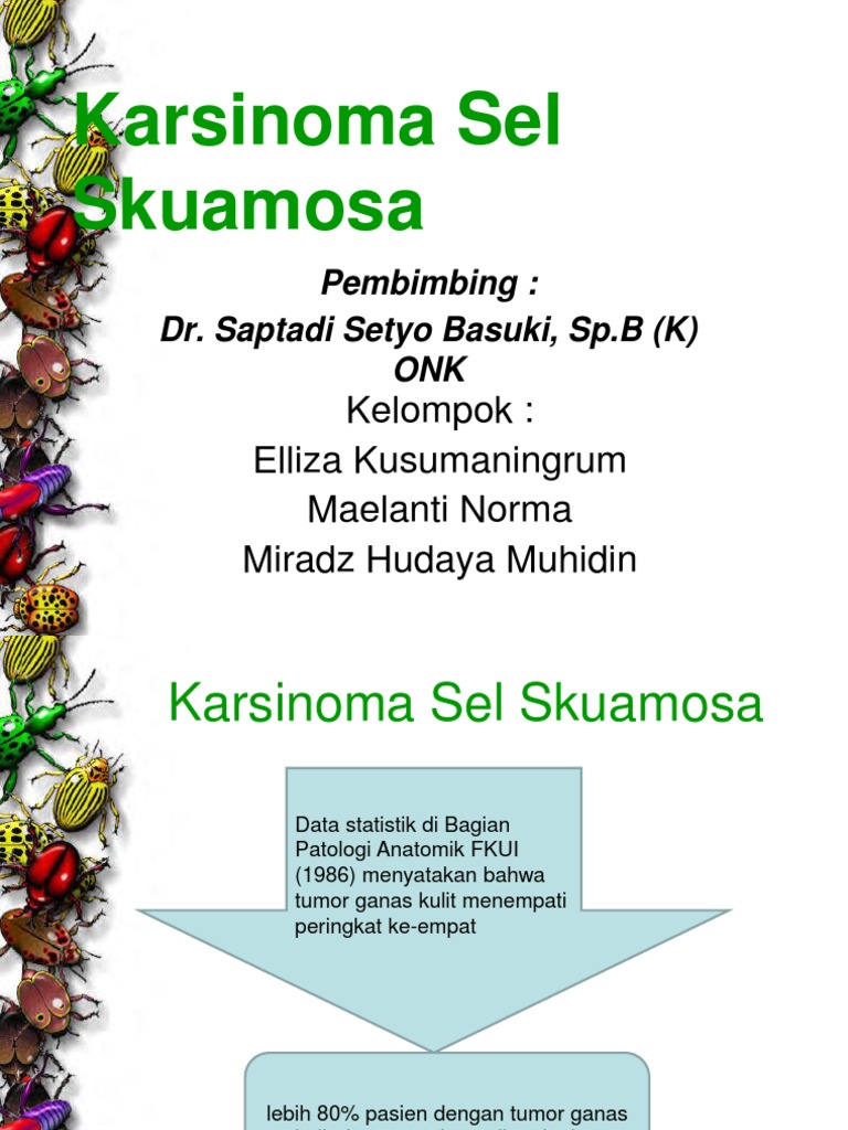 Karsinoma Sel Skuamosa PPT Edit | PDF