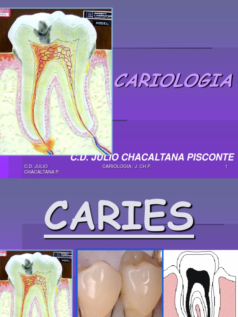 CARIOLOGIA | PDF | Esmalte de dientes | Diente