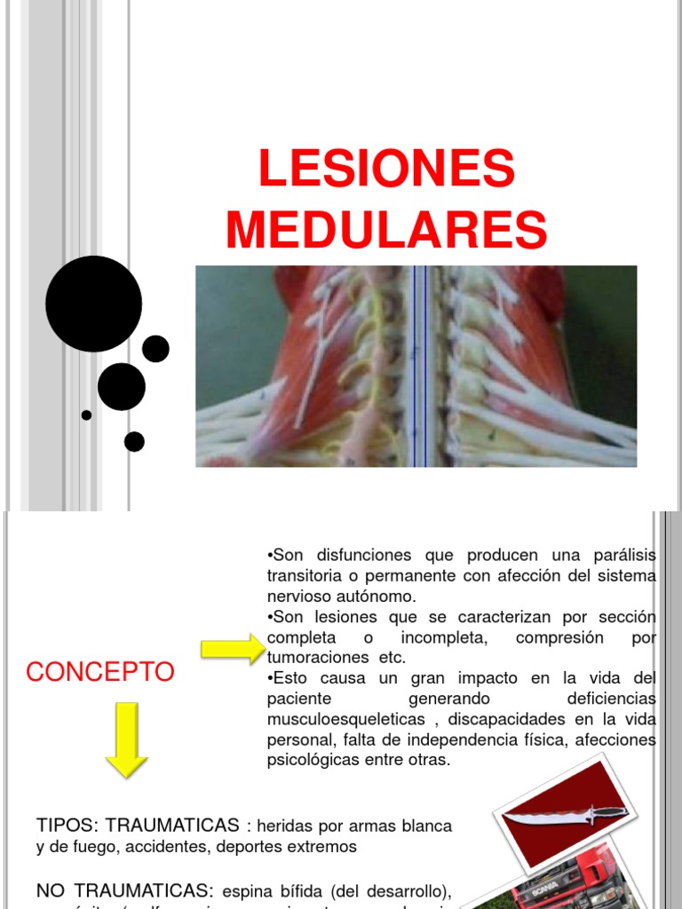 LESIONES MEDULARES.pptx | Lesión de la médula espinal | Codo