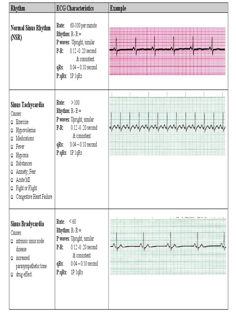 EKG Flash Chart | Electrocardiography | Cardiovascular System