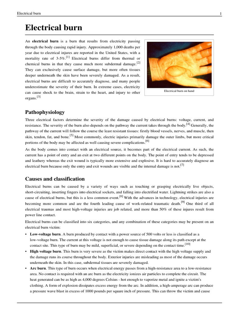 Electrical Burn PDF | PDF | Electromagnetism | Electrical Engineering