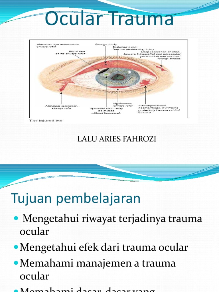 Trauma Ocular | PDF | Cornea | Human Eye