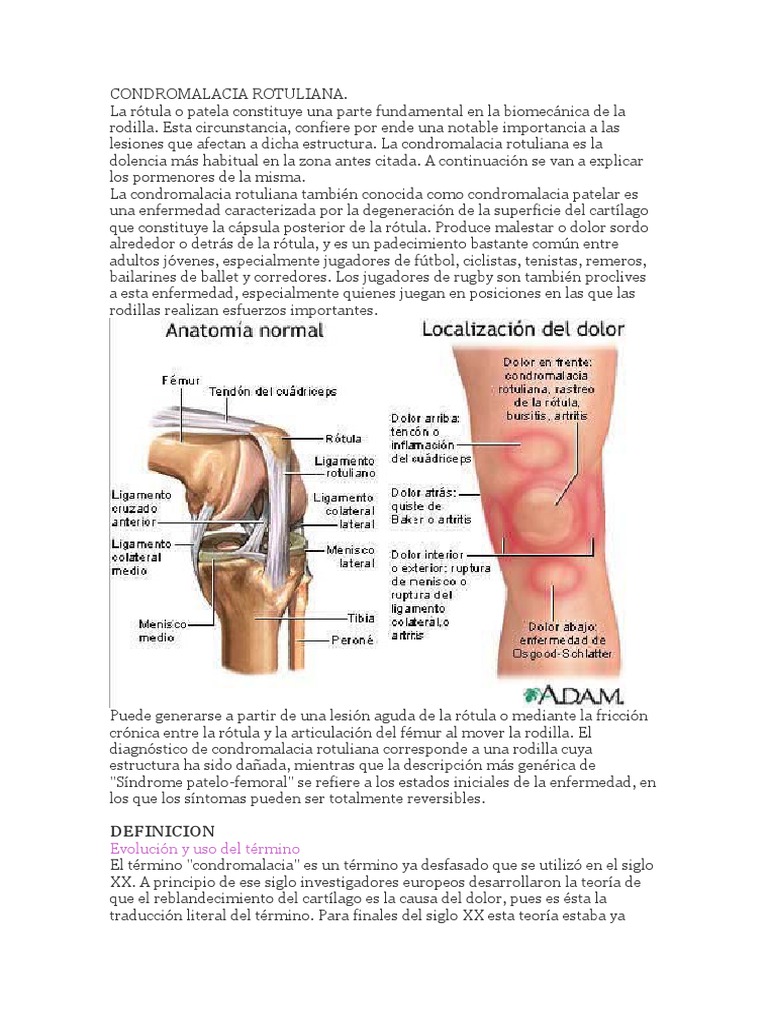 Condromalacia Rotuliana | Articulaciones | Sistema musculoesquelético