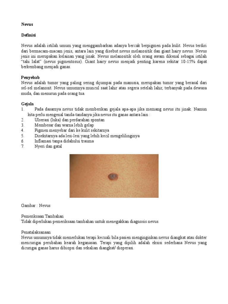 Nevus | PDF | Seni
