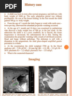 To Decrease Temperature by Means Through Evaporation and Conduction | PDF | Fever | Infection