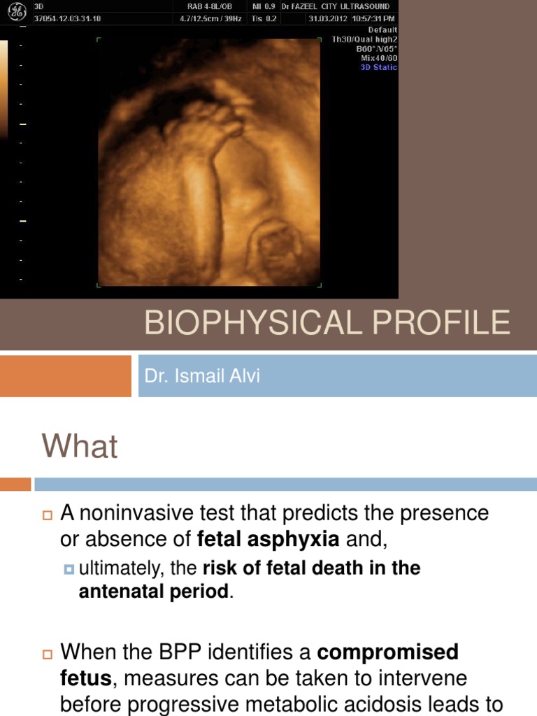 Biophysical Profile Antenatal Ultrasound | PDF | Childbirth ...