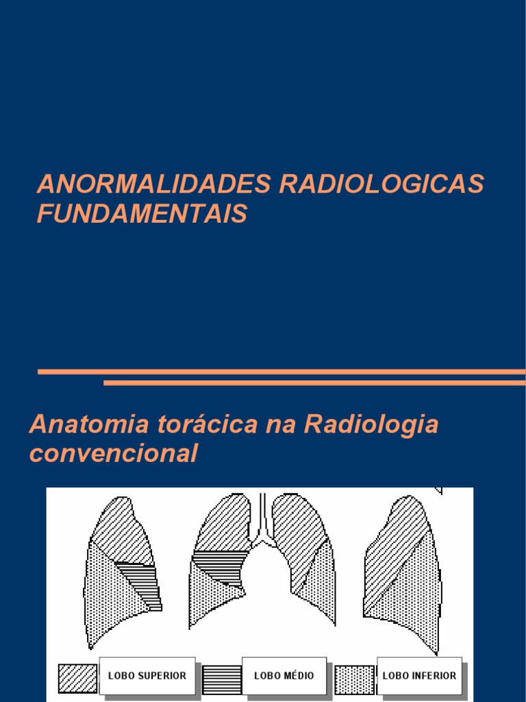Anormalidades Radiológicas Pulmonares | PDF | Tórax (anatomia humana ...