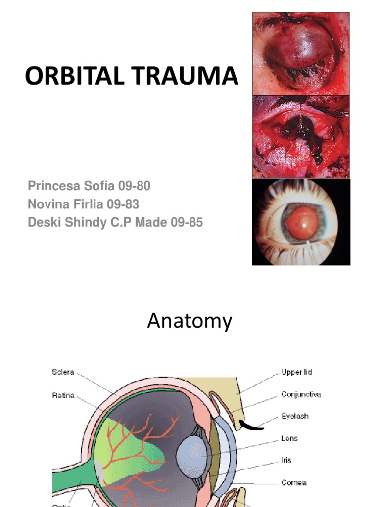 Trauma Orbital | PDF