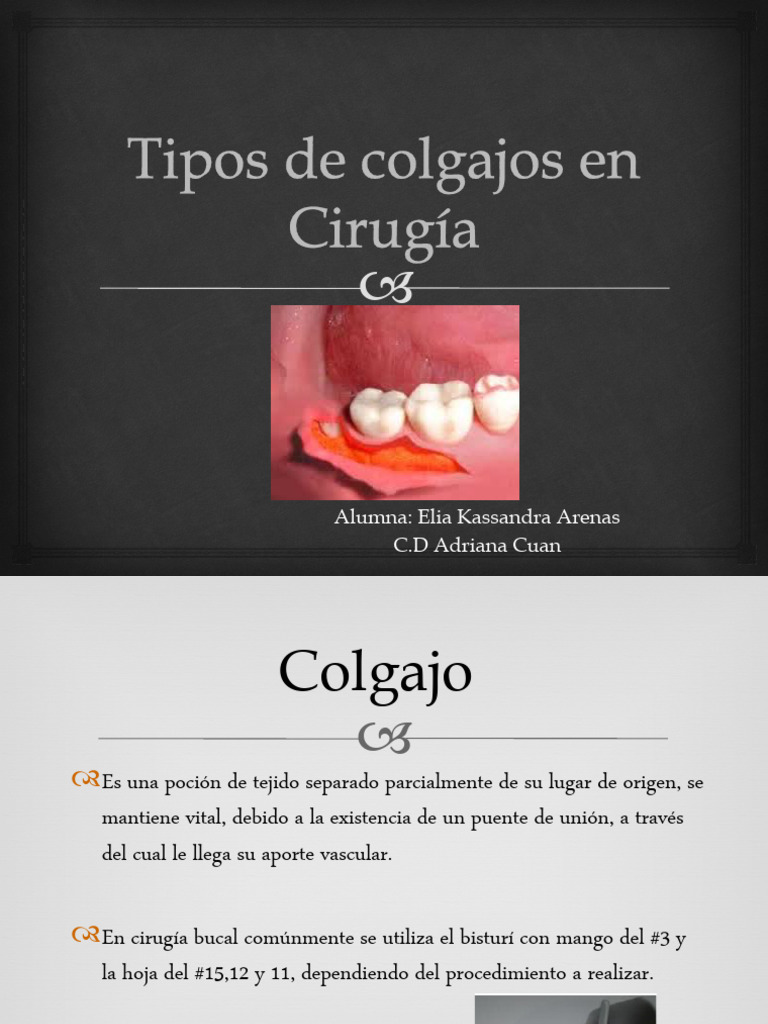 Tipos de Colgajos y Suturas en Cirugía - Kassandra | PDF | Hueso | Diente humano