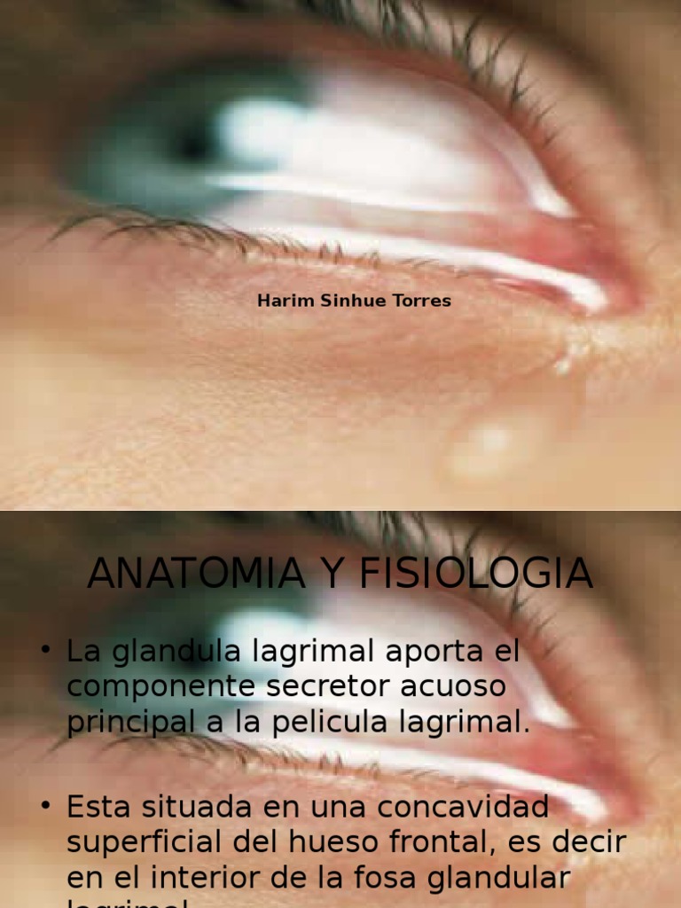 Dacrioadenitis: Diagnóstico y Tratamiento | PDF | Córnea | Inflamación