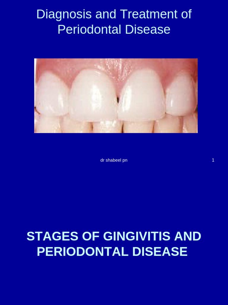 Diagnosis and Treatment of Periodontal Disease | PDF | Human Tooth ...