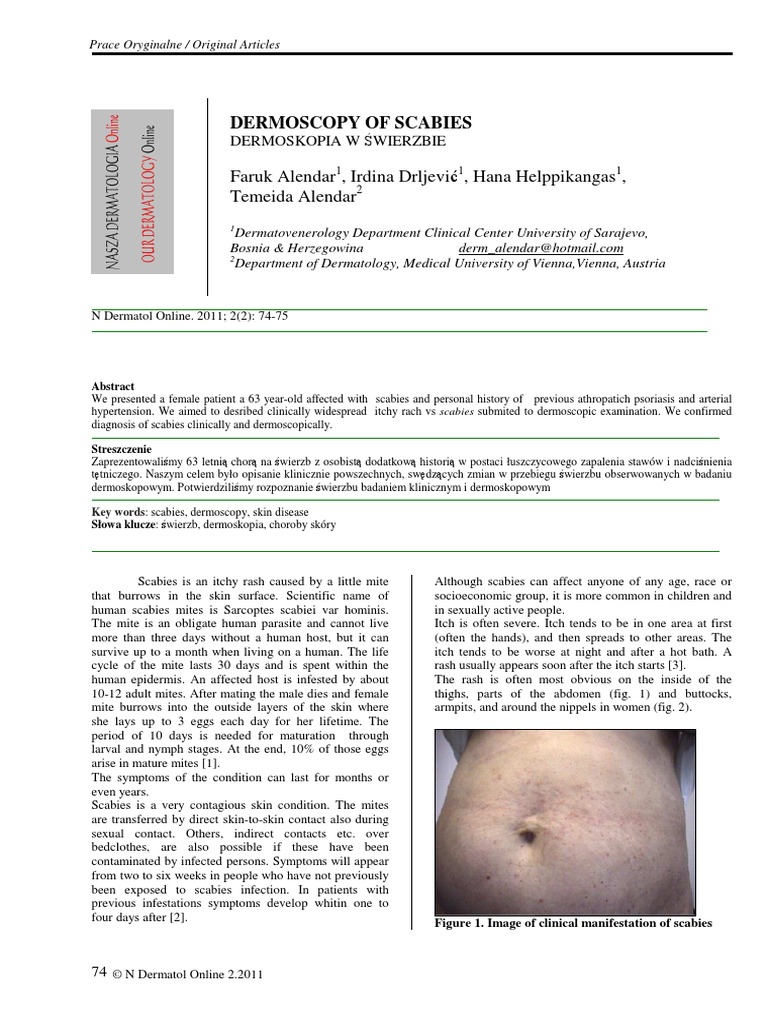 8 - Dermoscopy of Scabie | PDF | Cutaneous Conditions | Clinical Medicine