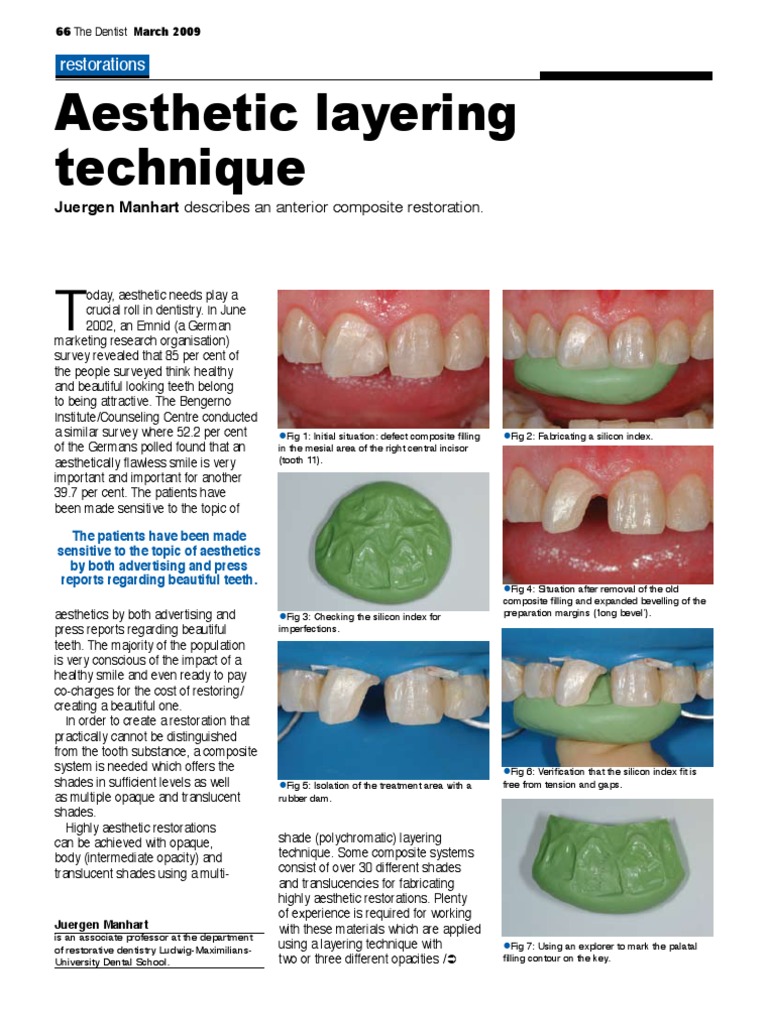 Aesthetic Layering Technique | PDF | Tooth Enamel | Dental Composite