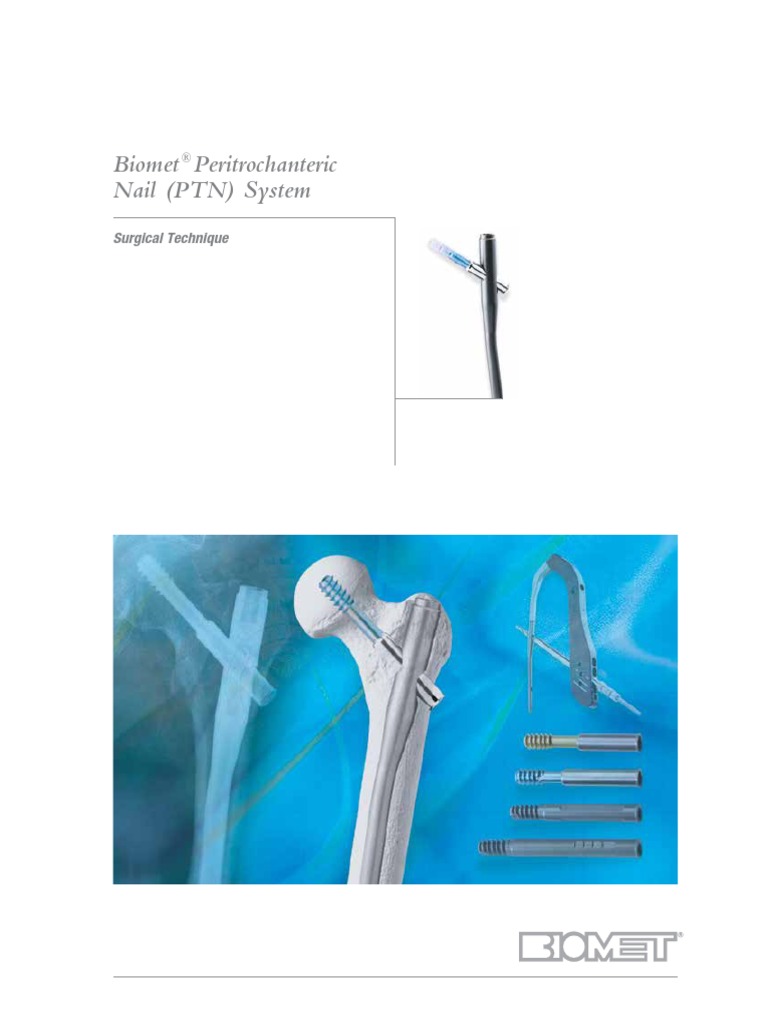 Peritrochanteric Nail Technique | PDF | Hip | Screw