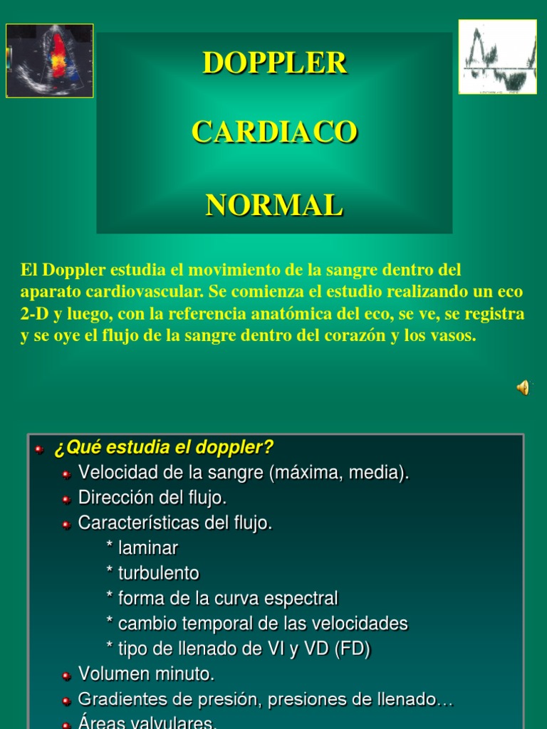 Doppler Normal(2) | Efecto Doppler | Vena