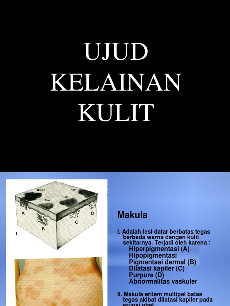 Ujud Kelainan Kulit | PDF