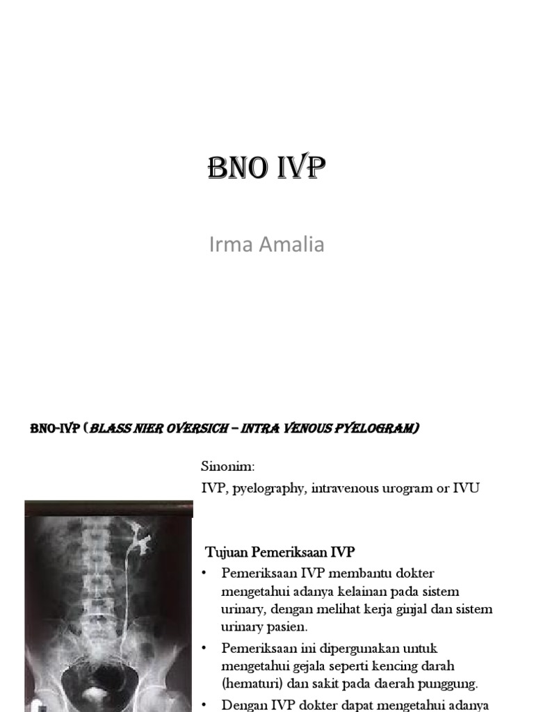 Bno Ivp | PDF