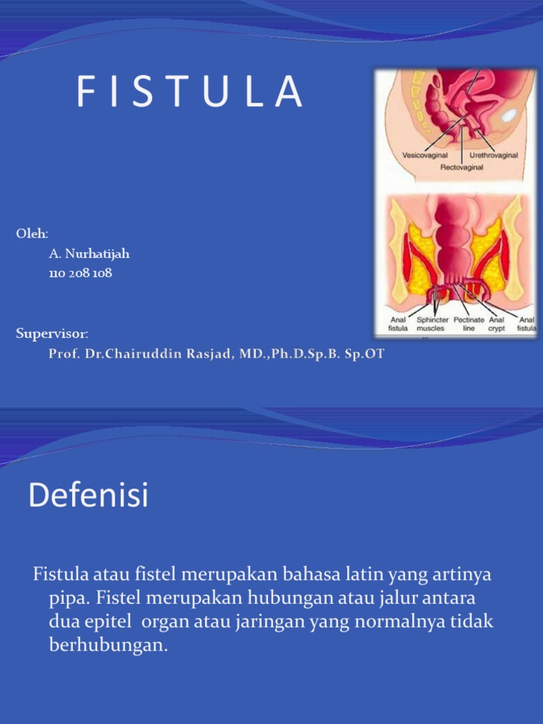 Fistel: Definisi, Jenis, dan Penanganan | PDF