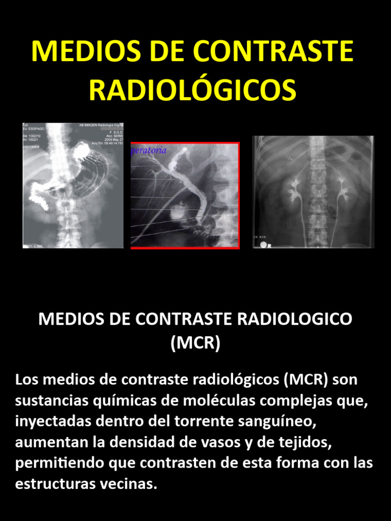 Medios De Contraste Radiológicos