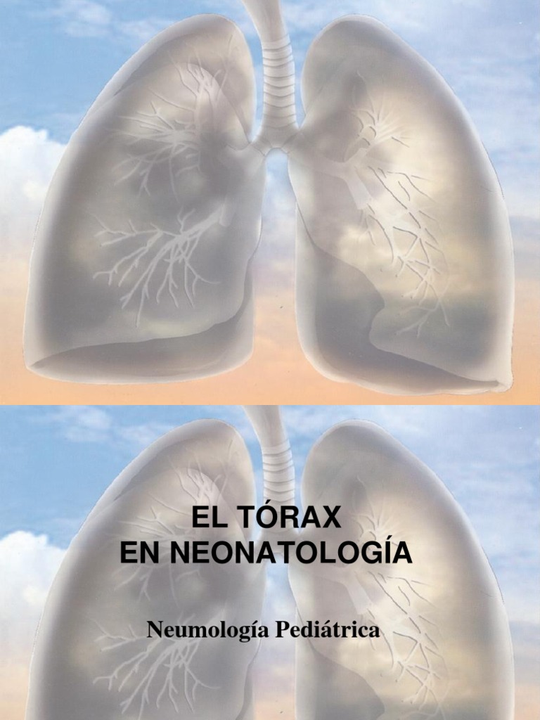 Torax Del Neonato | PDF | Pulmón | Parto prematuro
