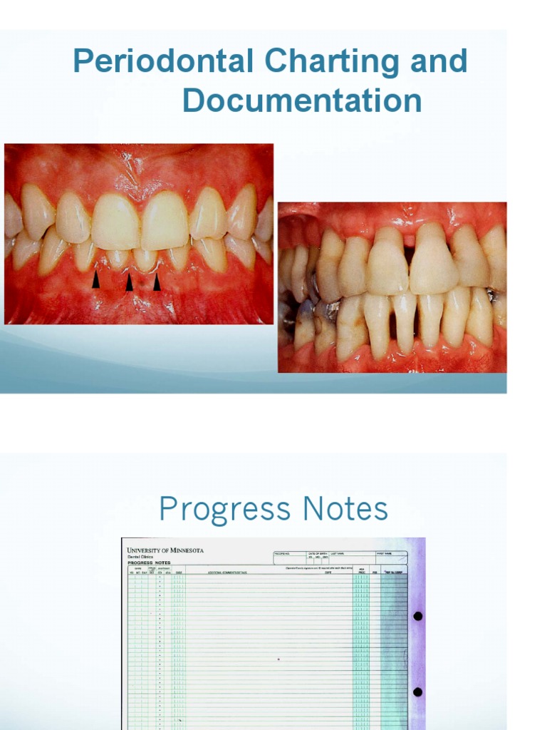 02a Perio Disease | PDF | Periodontology | Dentistry