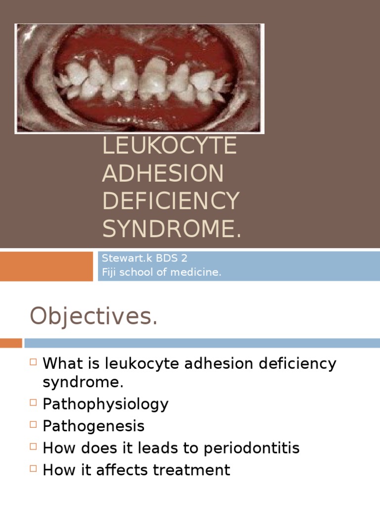 Leukocyte Adhesion Deficiency Syndrome | Cell Adhesion | White Blood Cell
