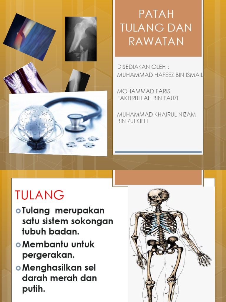 Patah Tulang Dan Rawatan | PDF