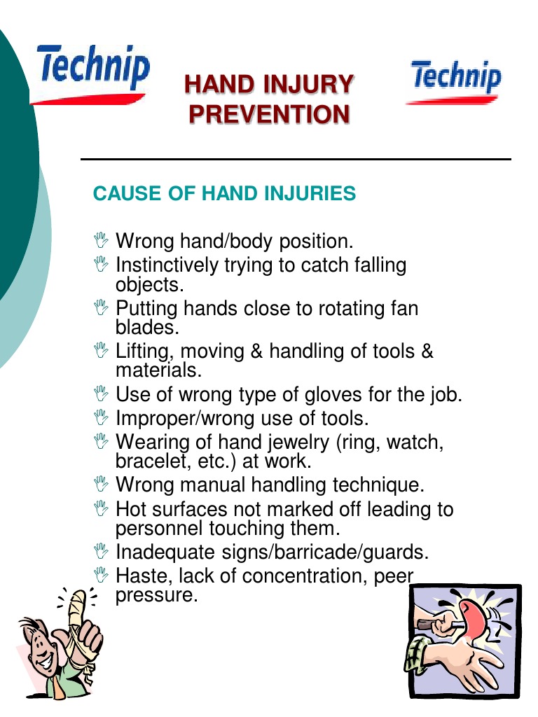 Hand Injury Prevention | PDF