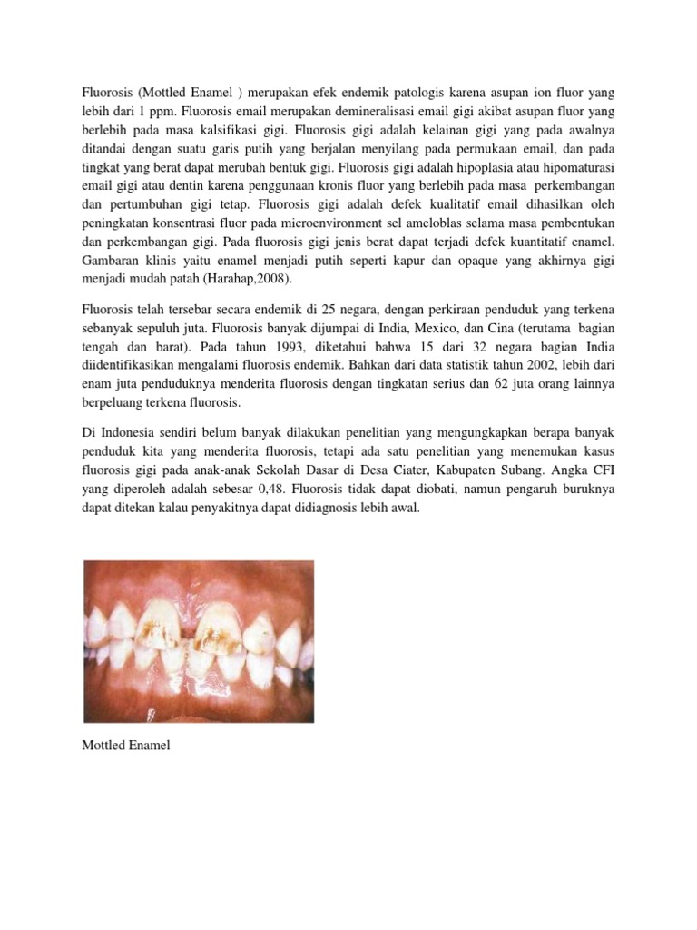 Mottled Enamel | PDF