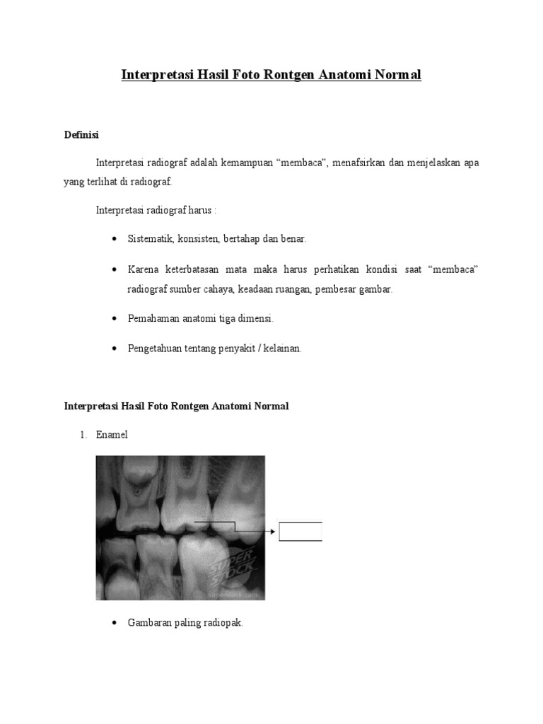 Interpretasi Hasil Foto Rontgen Anatomi Normal | PDF