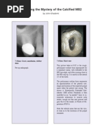 Hotkeys - Exocad | PDF | Cursor (User Interface) | Keyboard Shortcut