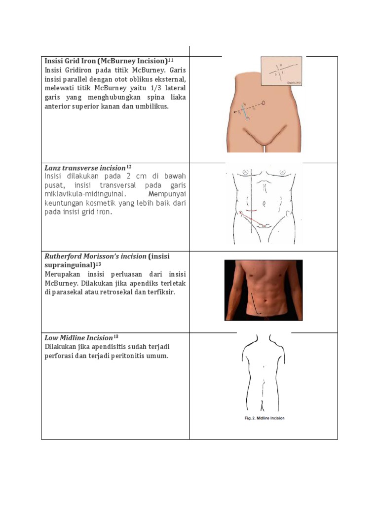 Insisi Grid Iron | PDF