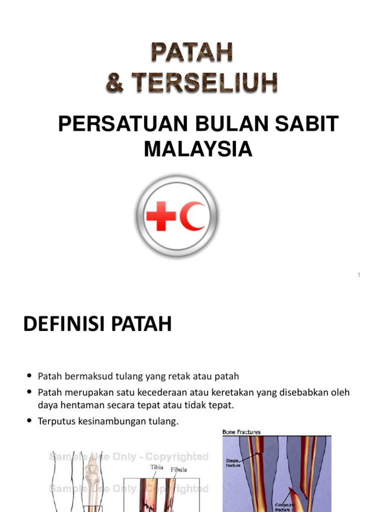 Rawatan Kecederaan Terseliuh dan Patah | PDF | Kajian Bahasa Asing