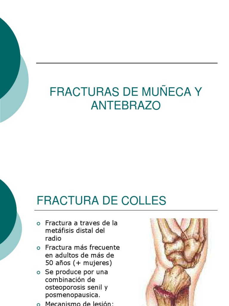 Fracturas De Muñeca Y Antebrazo Pdf Mano Codo
