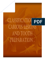 G.V. Black's Caries Classification Overview | PDF | Animal Anatomy ...