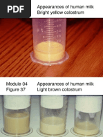 Infant Breastfeeding Assessment Tool (IBFAT) | PDF | Breastfeeding ...