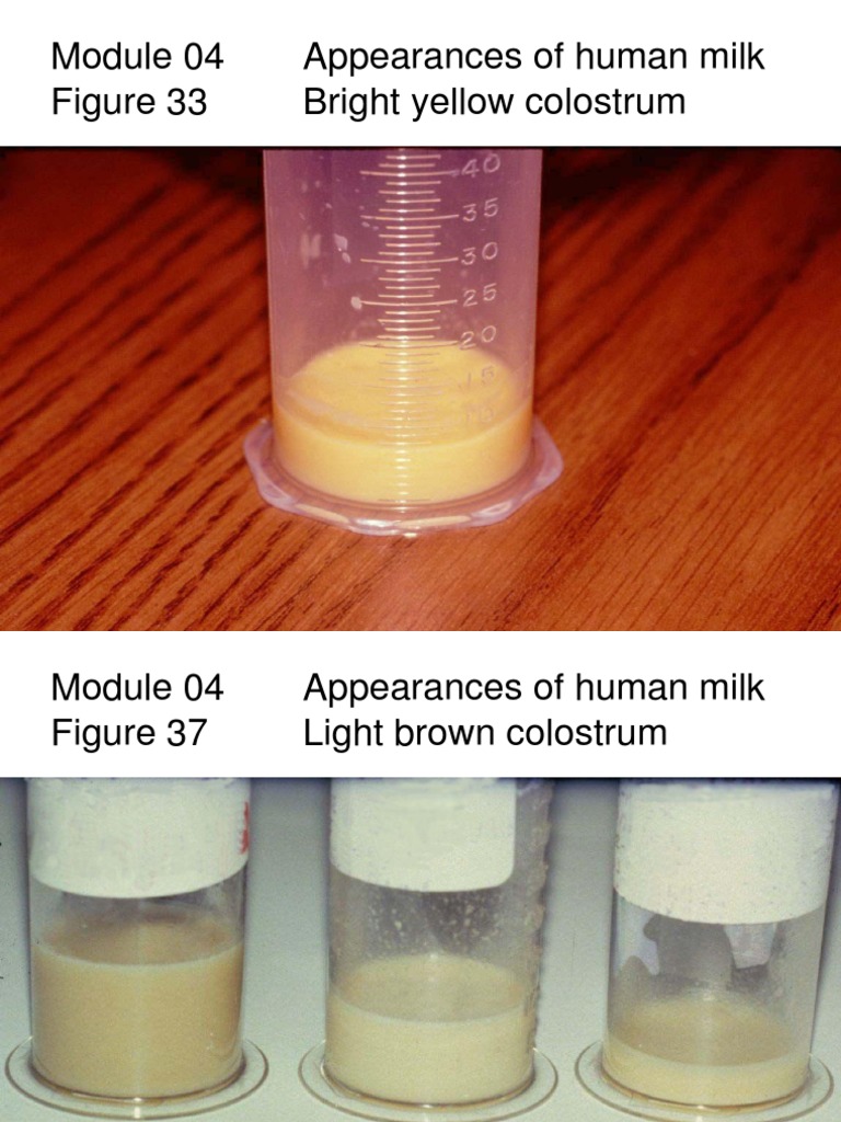Appearances of Human Milk Bright Yellow Colostrum | PDF | Nipple ...