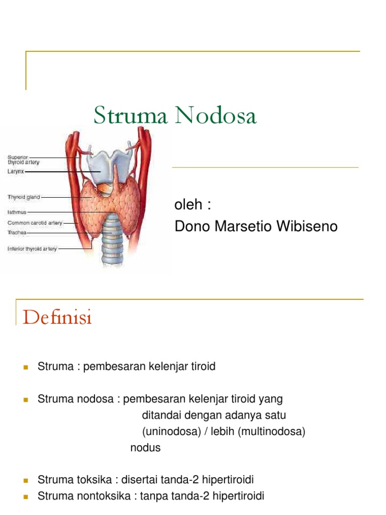 Struma Nodosa | PDF