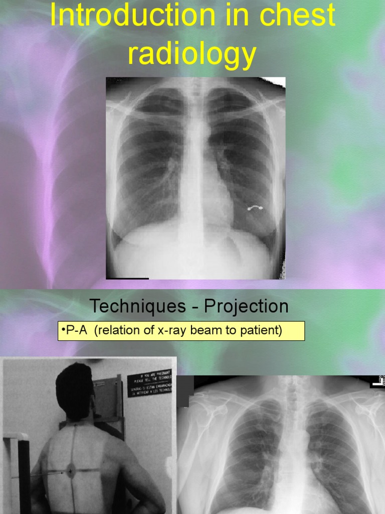 Chest Radiology: Anatomy and Techniques | PDF | Thorax | Aorta