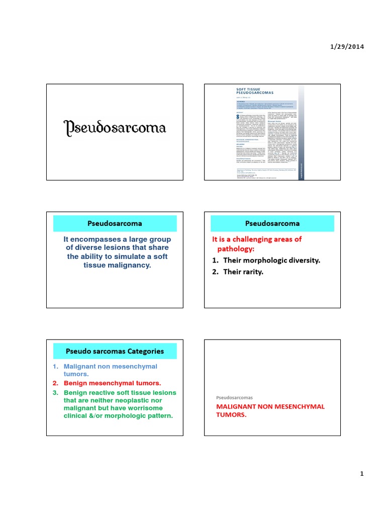Sarcoma Like Lesion Pseudosarcoma PDF | PDF | Neoplasms | Sarcoma