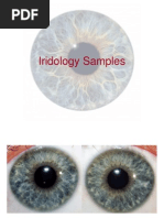 Iridology: Reading Iris Health Signs | PDF | Medical Specialties | Anatomy