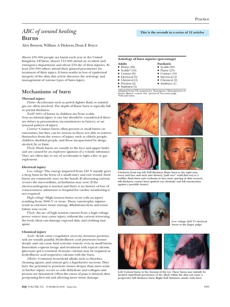 Burns: ABC of Wound Healing | PDF | Burn | Clinical Medicine