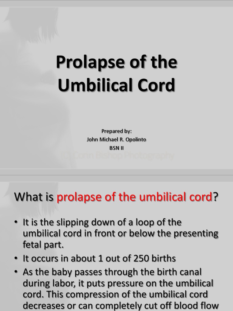 Prolapse of the Umbilical Cord | Fetus | Childbirth