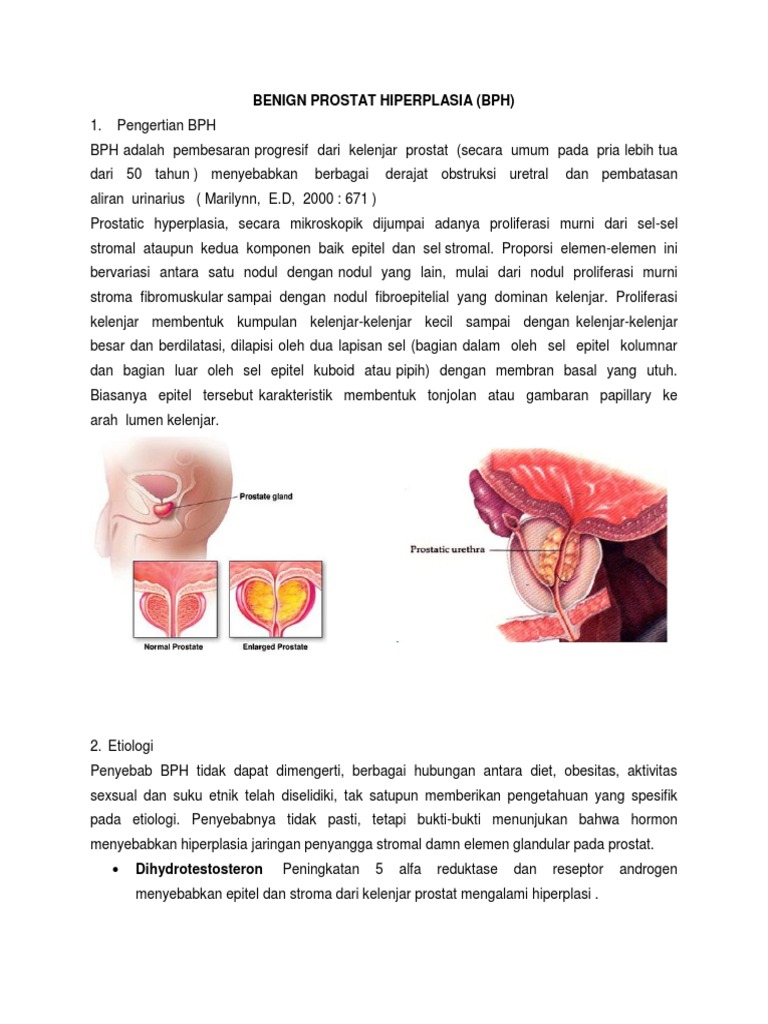 Benign Prostat Hiperplasia | PDF