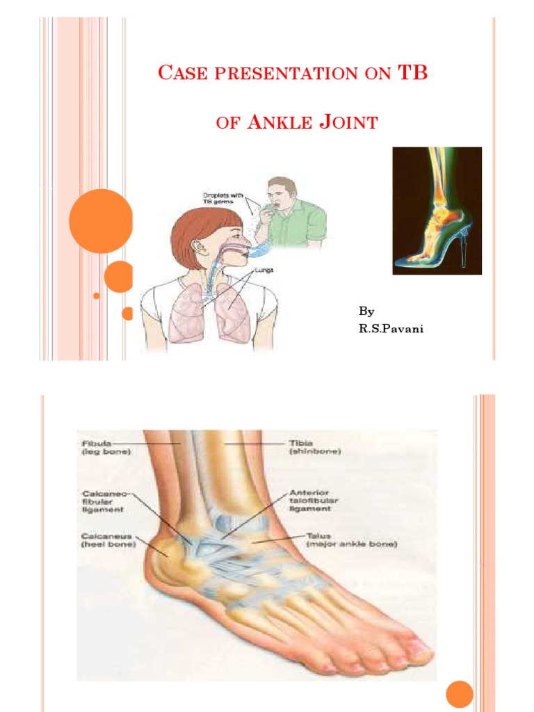 Tuberculosis of Ankle Joint | PDF