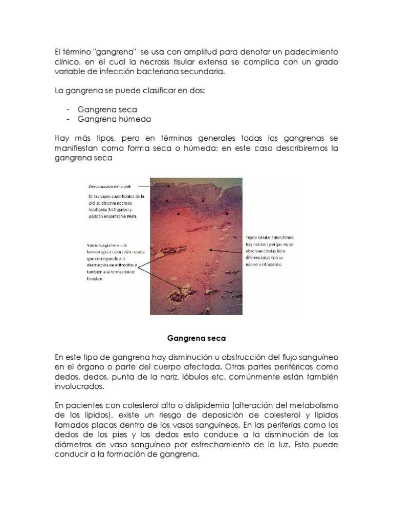 Gangrena Seca TITA | PDF | Diabetes mellitus | Sangre