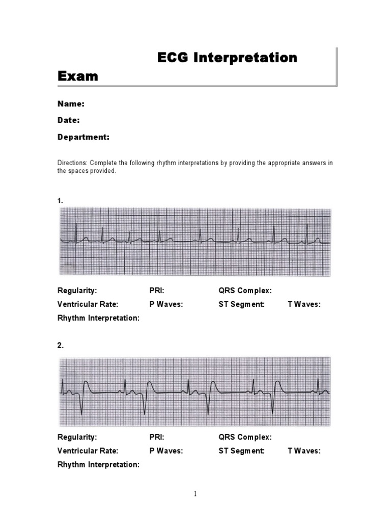 Basic EKG Interpretation Exam | Electrocardiography | Cardiovascular System