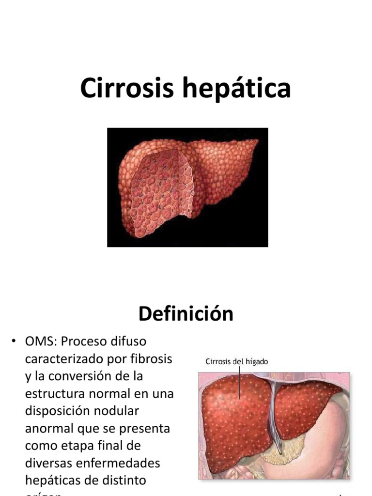 Cirrosis Hepática Pptx Cirrosis Anatomía