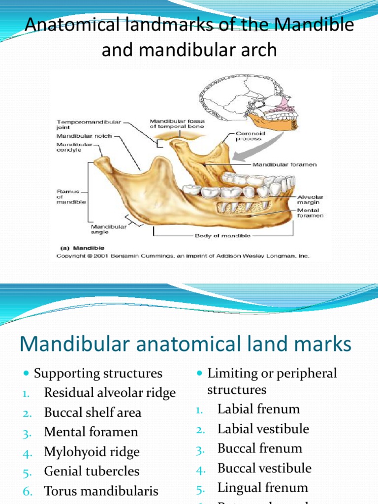 Mylohyoid Ridge Denture